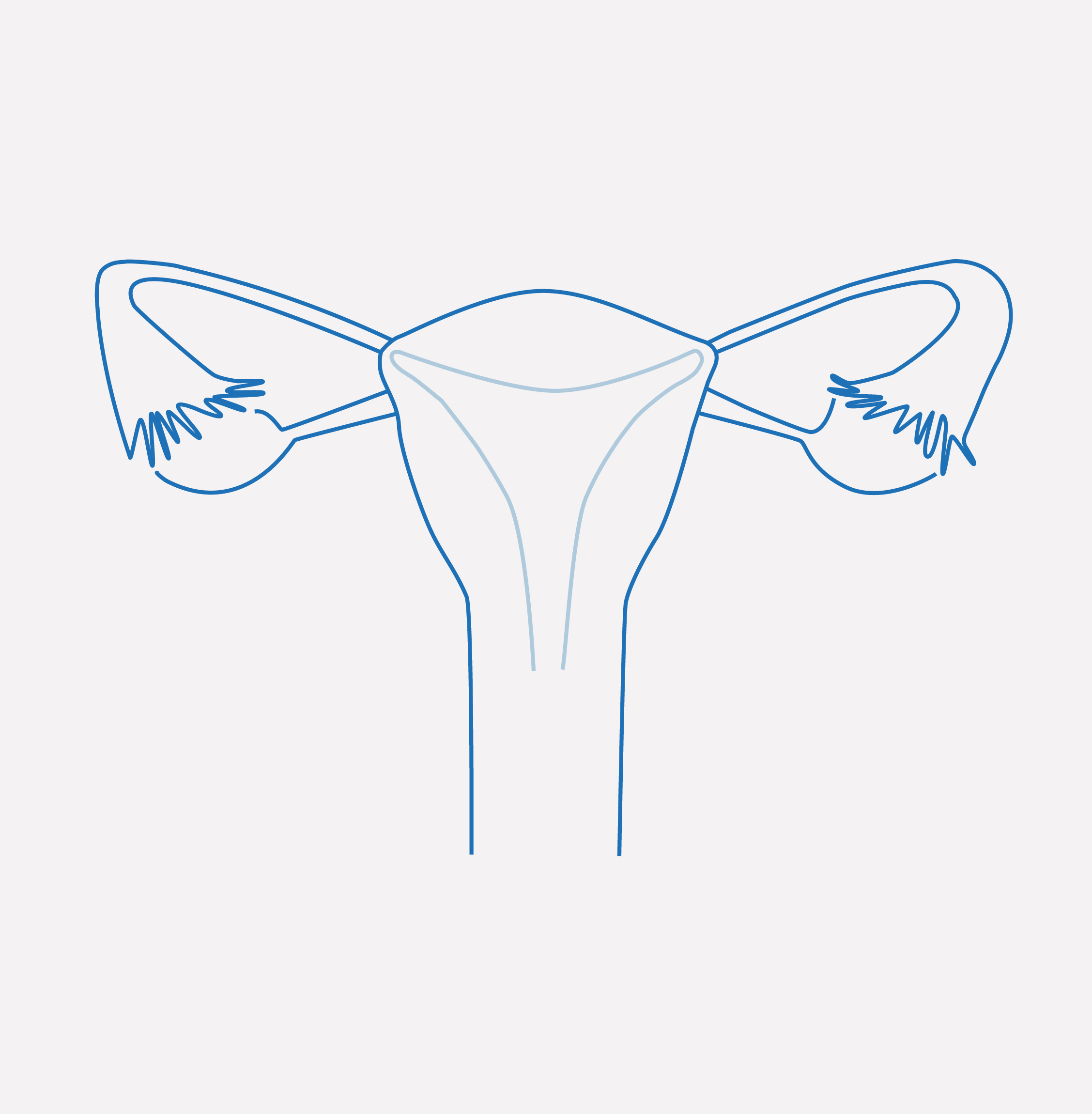 Chirurgie de l’endométriose - CHC Montlégia (Liège)